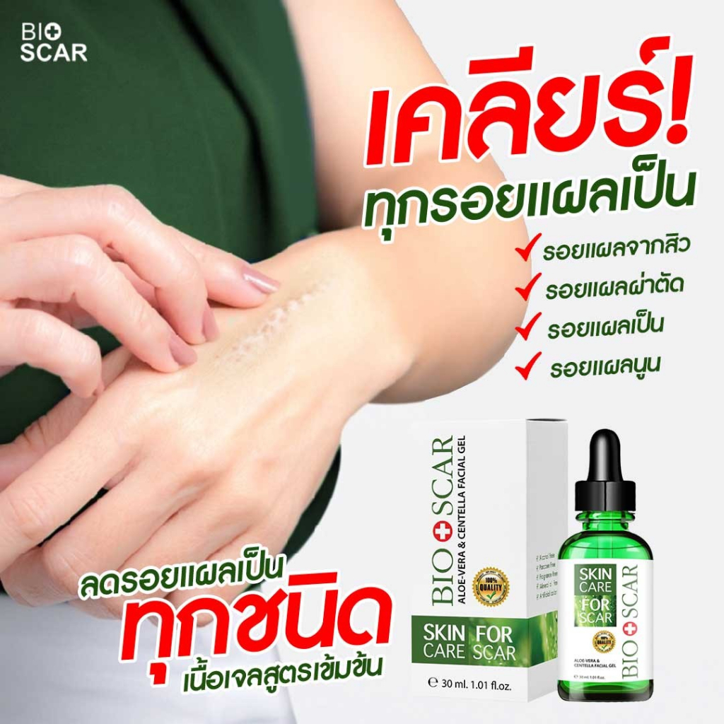 Bio scar Reduce Scars Stretch Marks Remove Embossed Wounds | Shopee ...