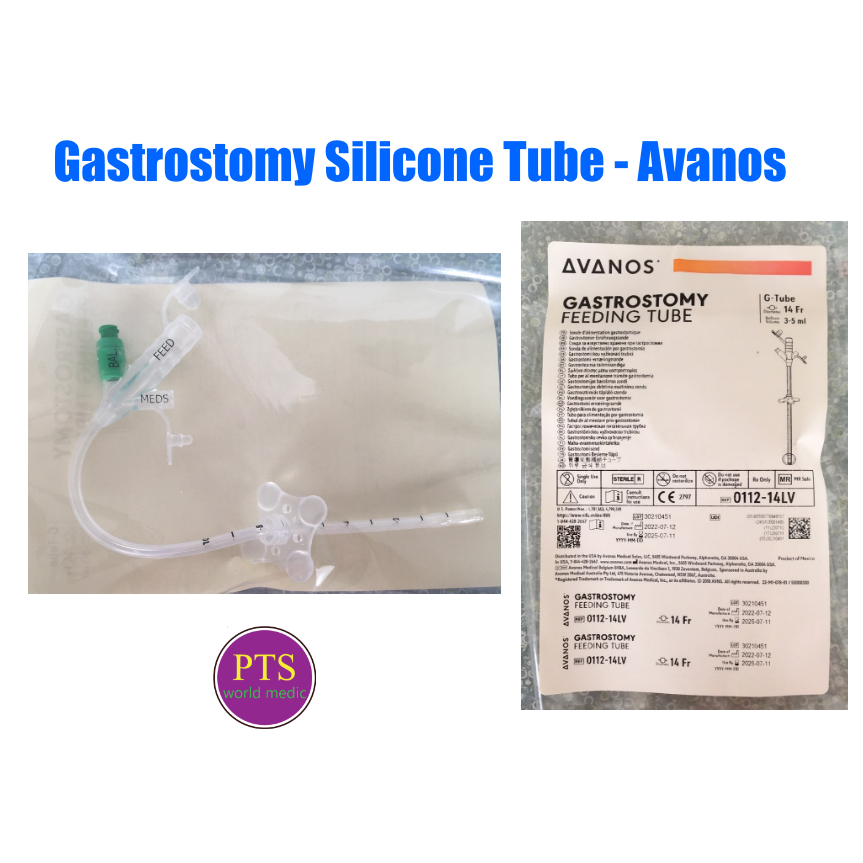 Abdominal Feeding Cable Gastrostomy Silicone Tube (PEG Tube)-Avanos ...