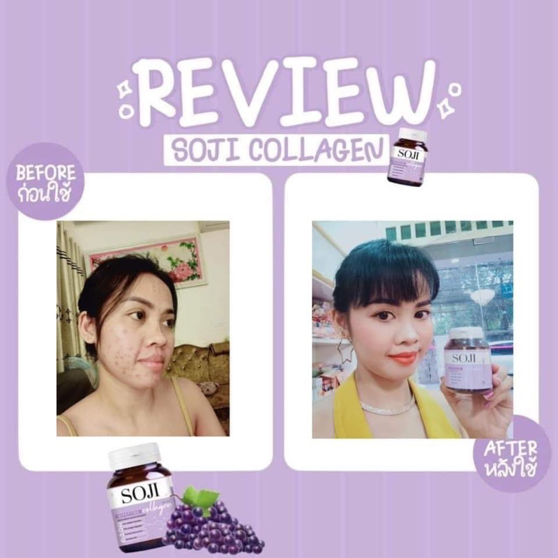 SOJI COLLAGEN (30 Tablets) Chewable Tablets | Shopee Malaysia