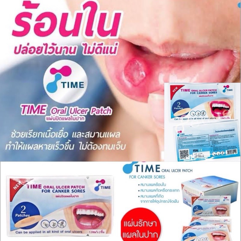 Hot Wound Patch In TIME Oral Ulcer For 1 Sachet 4 Pieces | Shopee Malaysia