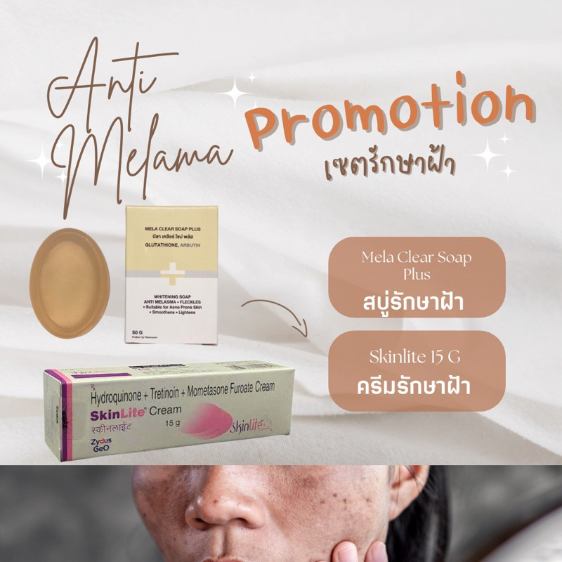 Hot Selling best seller Skinlite 15 G + Mela Clear Soap Plus 50 Blemish ...