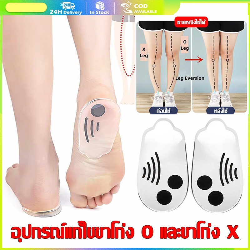 Leg Pads Shapes O-Legs X-Legs Orthopedic Heel Insoles Corrective Foot ...