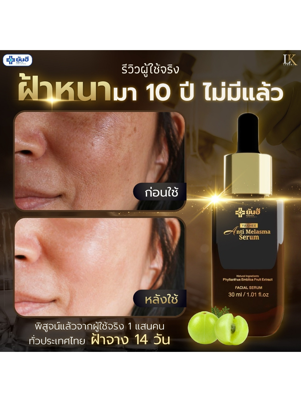 9.25 Yanhee Red Energy Saver Set 1 Bottle + Anti Melasma Serum 1 Free 1 ...