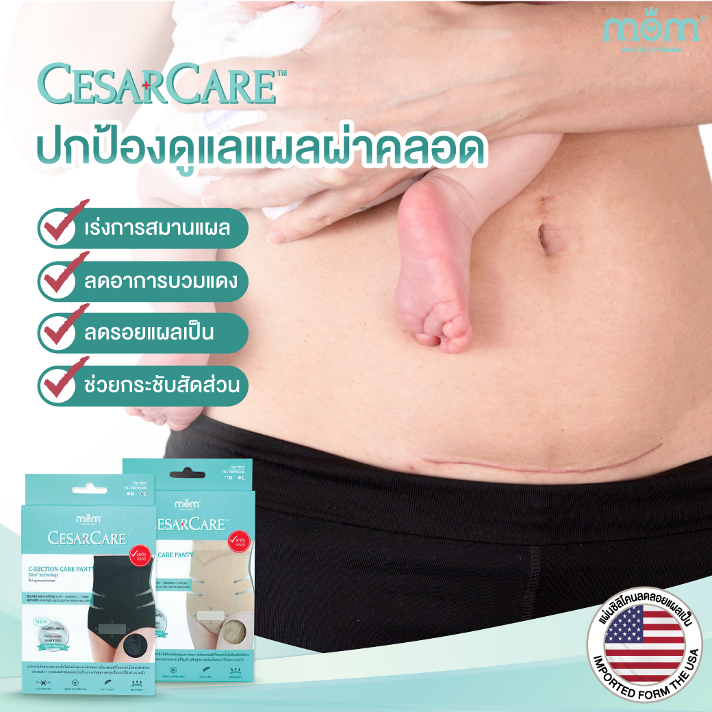 Ministry of Mama-CesarCare Nude Inner Layer of Cesarean Sections Care Cream Color | Shopee Malaysia