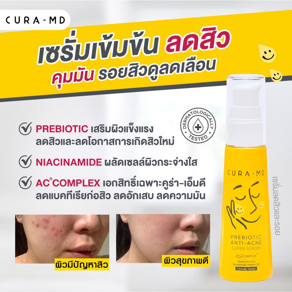 Cura MD Prebiotic Anti Acne Super Serum Brightening Skin Reduce Dark ...