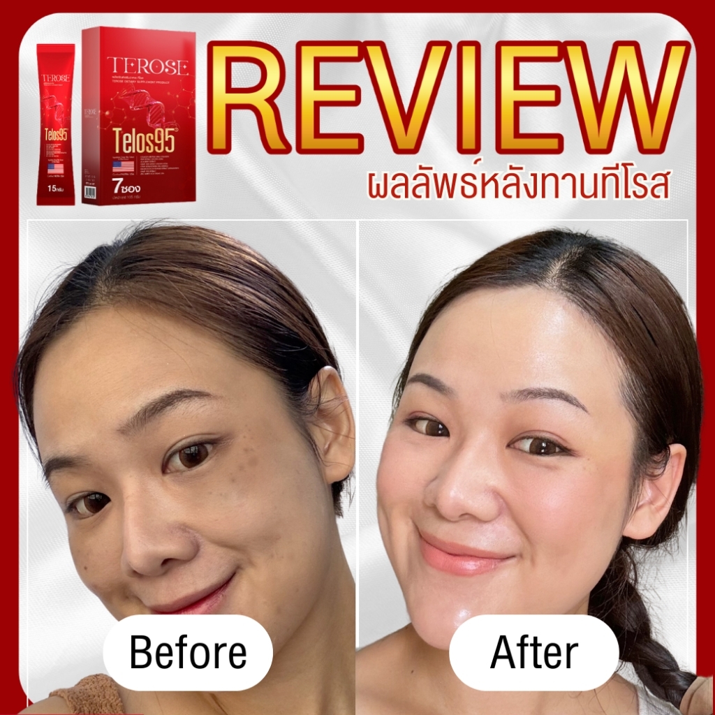 (4 Boxes Promotion) Japanelab TEROSE Telos95 Telos 95 Anti-Aging Reduce ...