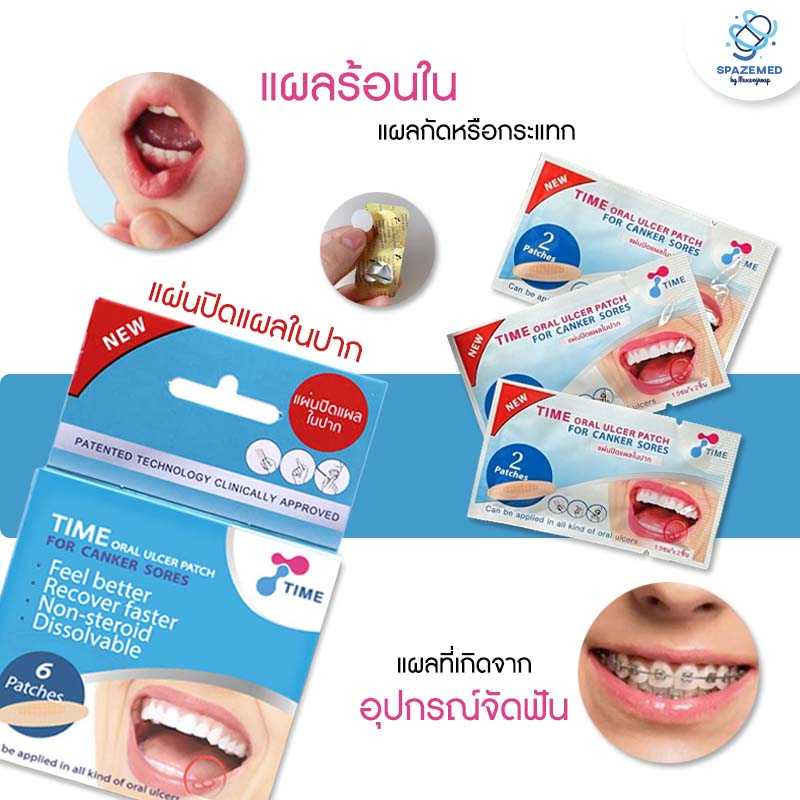 Hot ULCER PATCH 6pcs Mouth Box | Shopee Malaysia