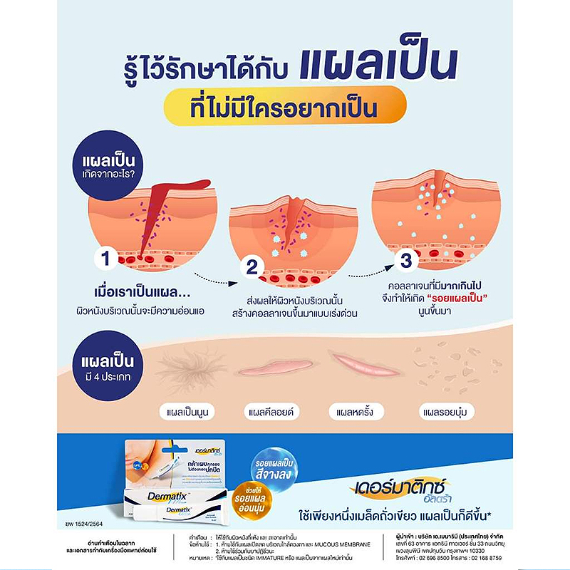 Dermatix Ultra Gel 15g Acne Scar To Reduce Treatment Cream Classic ...