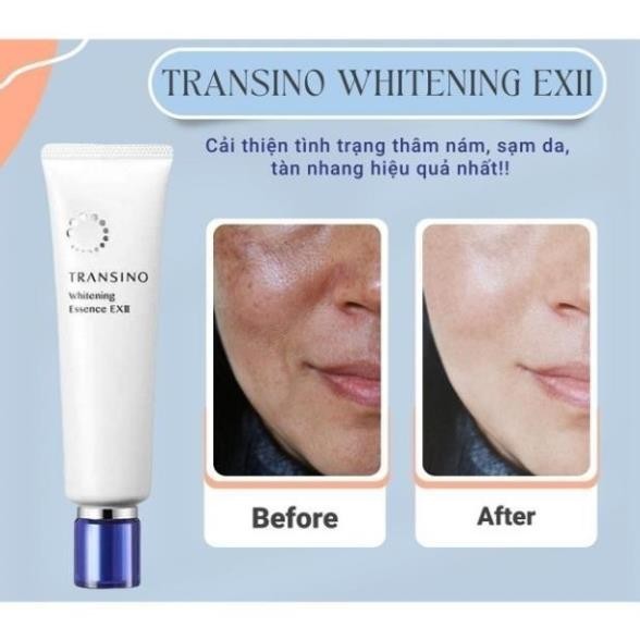 Transino Cream Slingshotm reducing essence freckles intensive whitening ...
