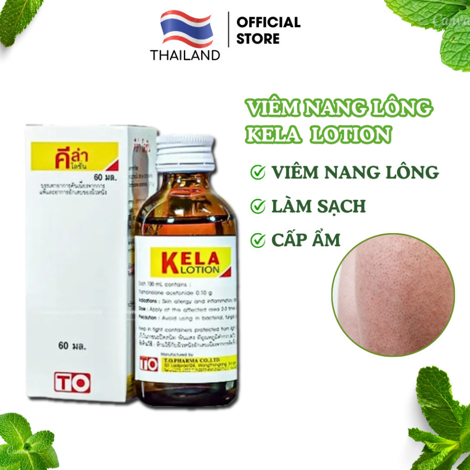 Kela folliculitis, folliculitis kela Thai herbal lotion 30ml, 60ml - | Shopee Malaysia