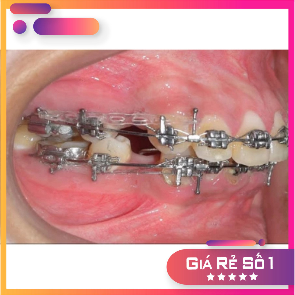 Dental string elastic - Orthodontic elastic roll | Shopee Malaysia