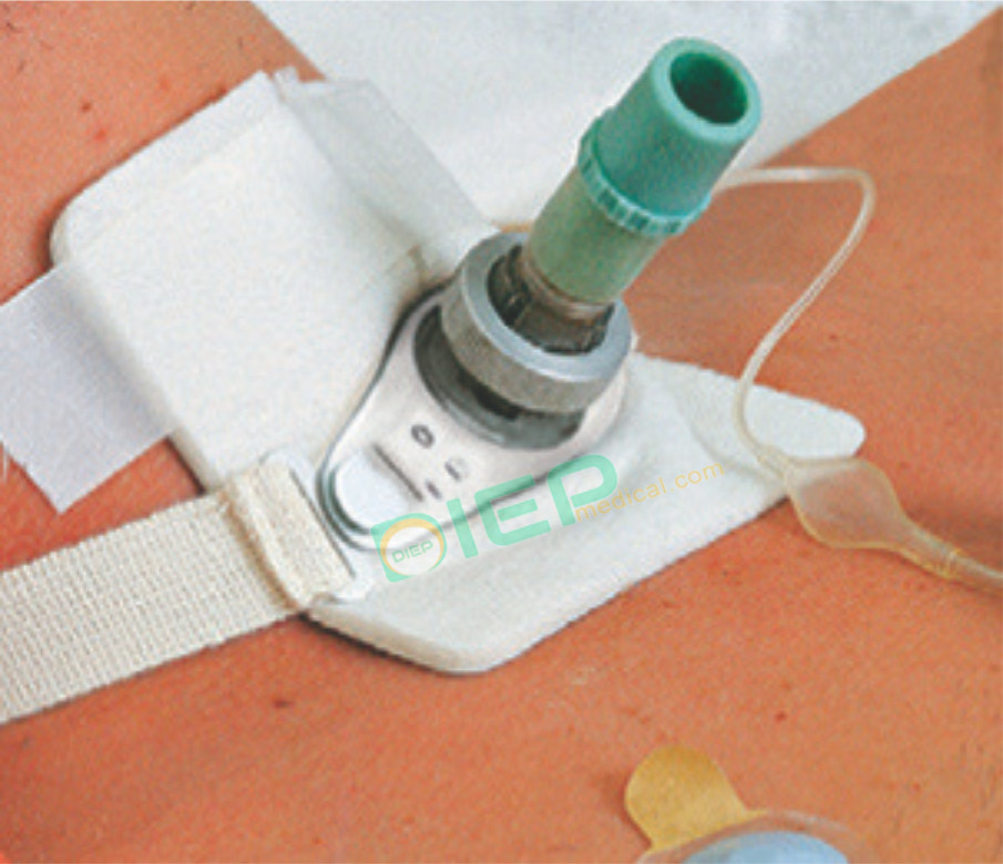 L&r METALLINE (6x7cm or 8x9cm) - Combo of 10 gauze pieces placed around ...