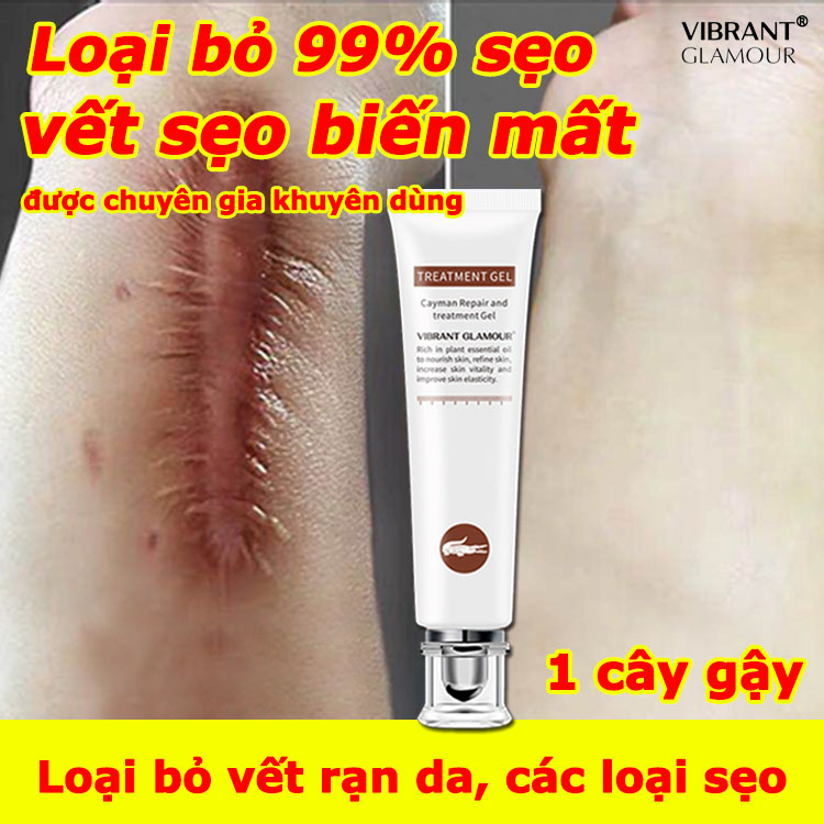 Effective After 3 Days, Scarring Cream 20g Scarring Cream Caused By ...