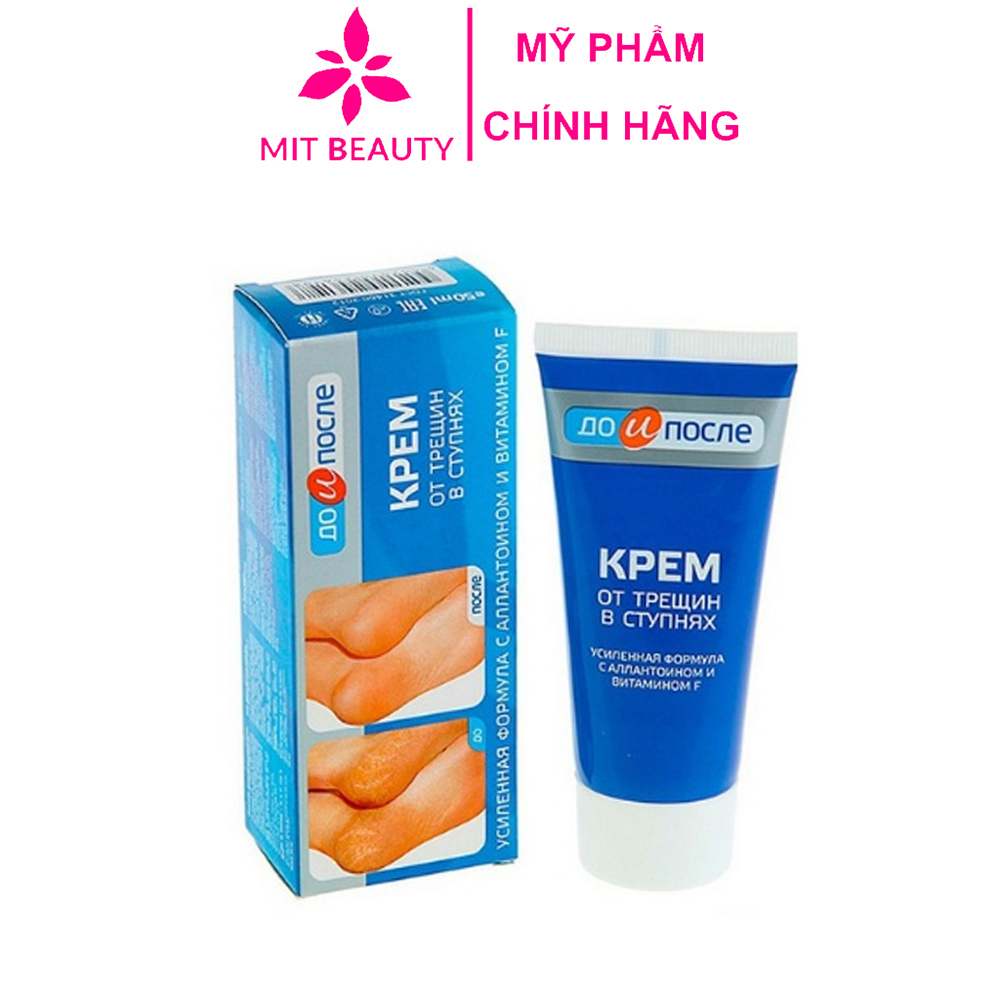 Kpem cracked heel cream 50ml Nga Mit Beauty stimulates regeneration and ...