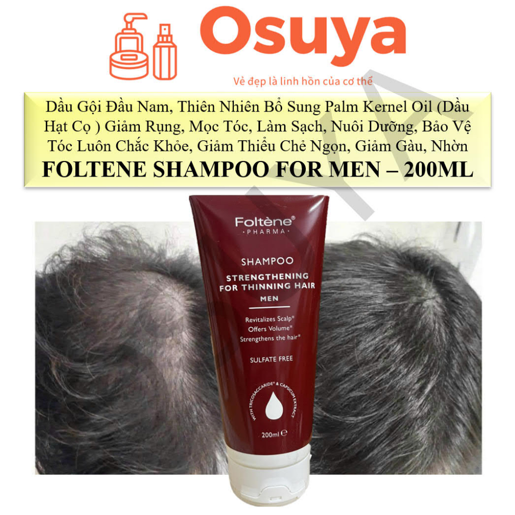 Foltène SHAMPOO FOR MEN TO REDUCE LOSS, REDUCE OIL, DANDRUFF, HAIR ...