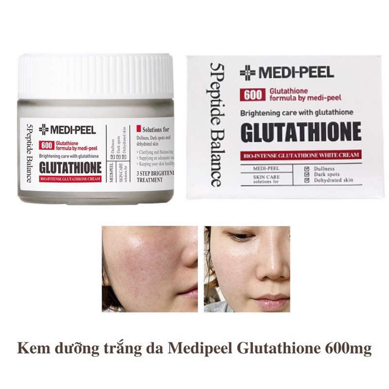 Medipeel GLUTATHIONE 600 WHITENING CREAM 50gr | Shopee Malaysia
