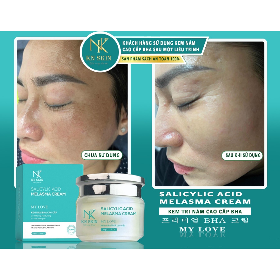 Kn SKIN Premium Melasma Cream, Blurring Spots, Mild Dark Spots, Dark ...