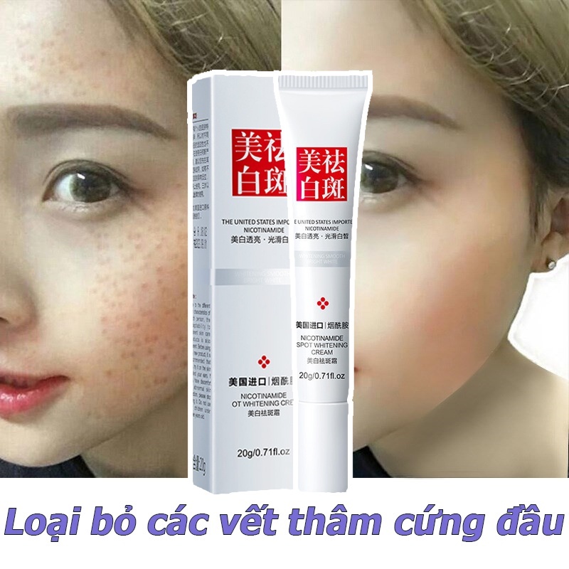 Chinese Facial Whitening Cream to Remove Freckles and Dark Spots 30g ...