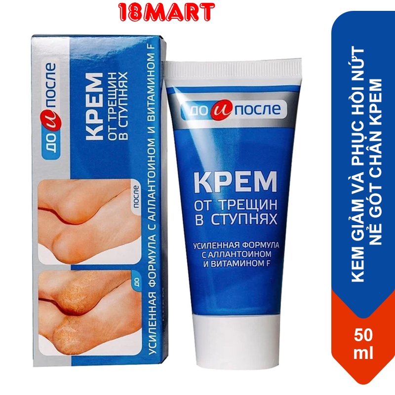 Kpem Heel Reducing And Restoring Cream 50ml | Shopee Malaysia