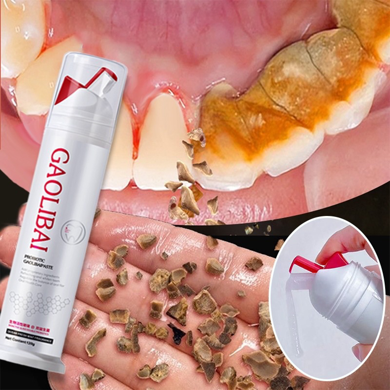 Gaolibai nano silver Gel removes tartar, cleans plaque and whitens ...