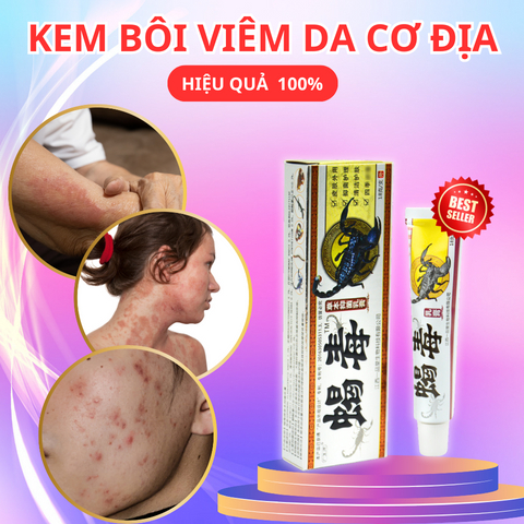 Scorpion Skin Cream Supports Ringworm, Fungus, Itchy Head, Eczema ...