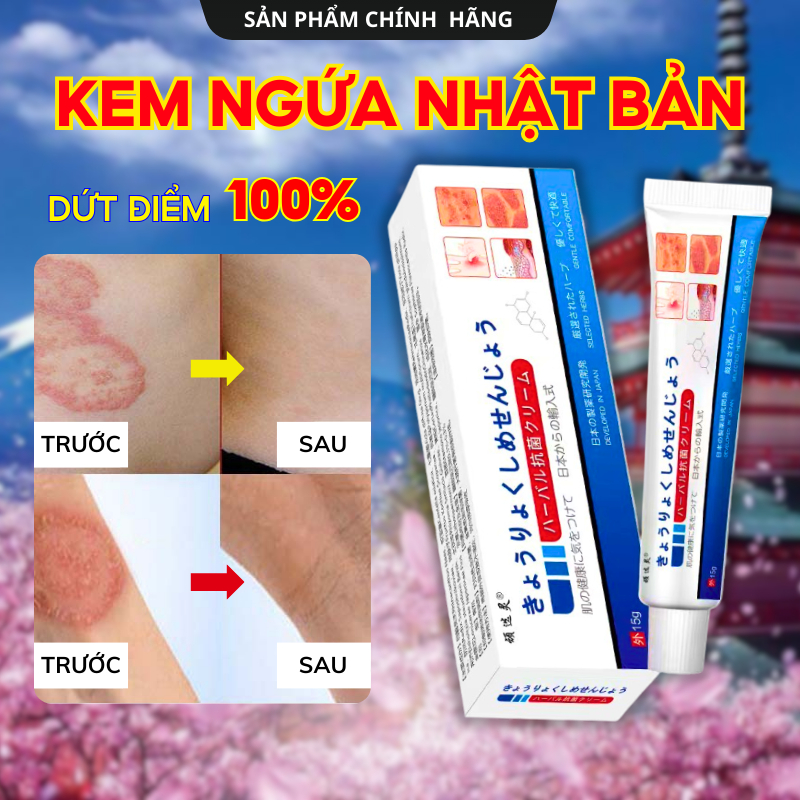 Japanese Atopic Dermatitis Itchy Fungus Cream Effectively Eliminates ...