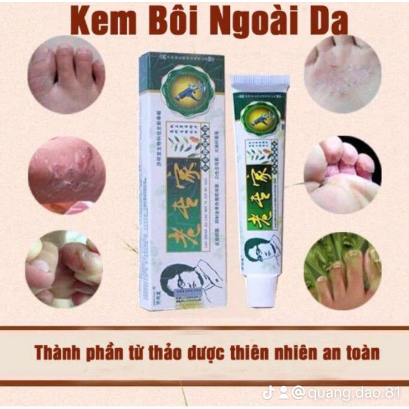 Green topical cream, for ringworm, tinea versicolor, psoriasis ...