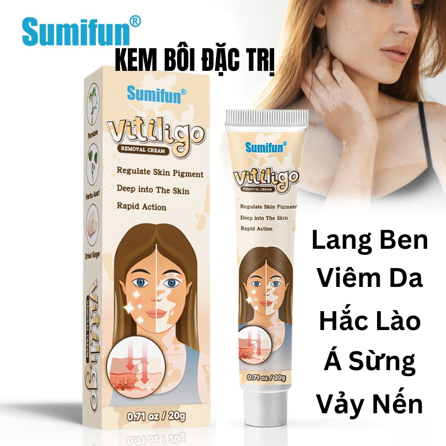 [GENUINE - 20g] Cream for albino, tinea versicolor, cream for ringworm ...