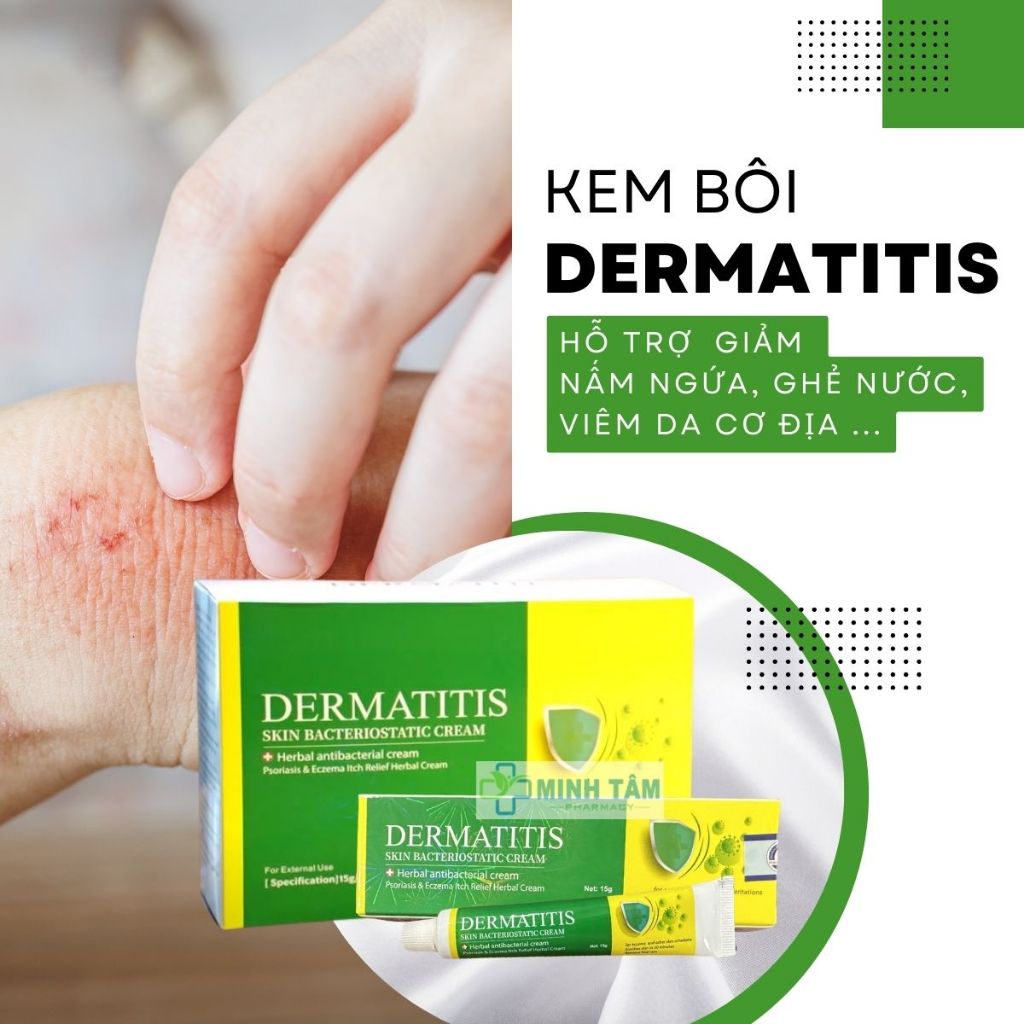 Genuine Dermatitis Skin Cream Helps Reduce Itchy Fungus and Atopic ...