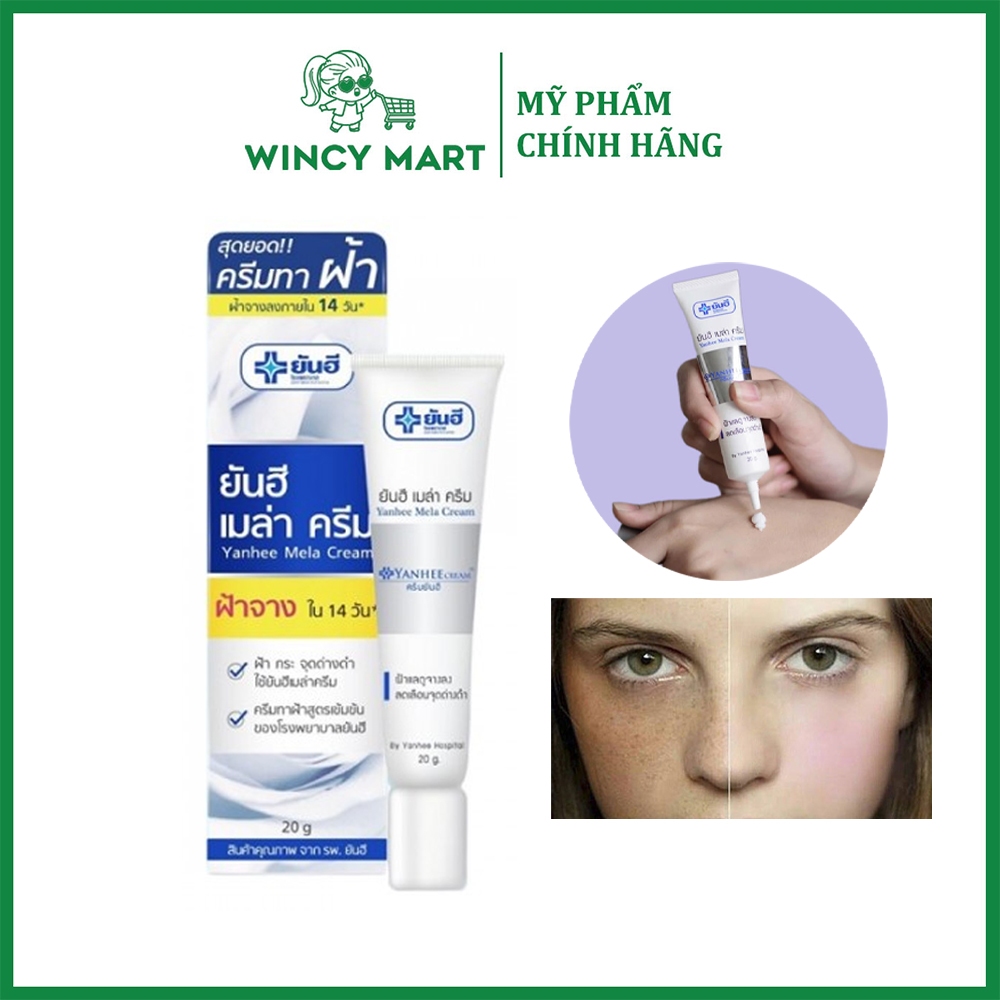 [Thai Standard] Slingshotm Yanhee Mela Cream, Freckles, Age Spots, Dark ...