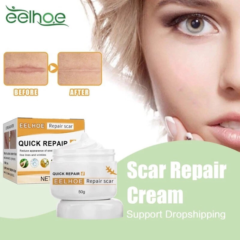 Cream Scar Removal Cream Removes stretch marks, removes scars, burn ...