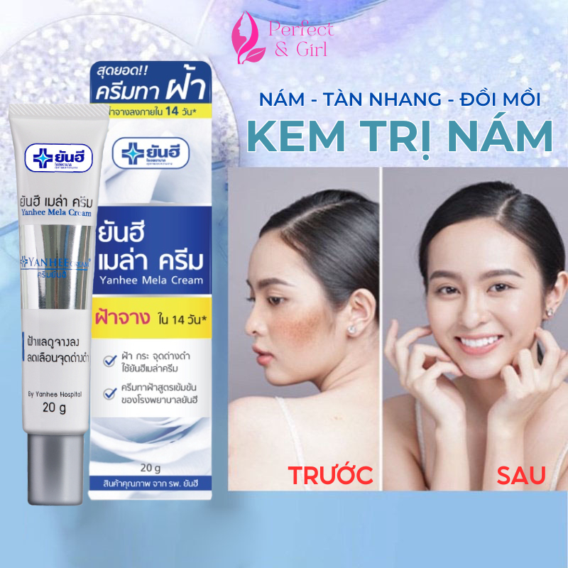 Yanhee Premium Matte FreckleSlingshot Cream Freckles Age Spots ...