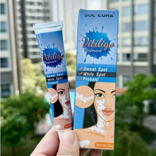 Vitiligo herbal tinea versicolor cream - Vitiligo topical cream, fungal ...