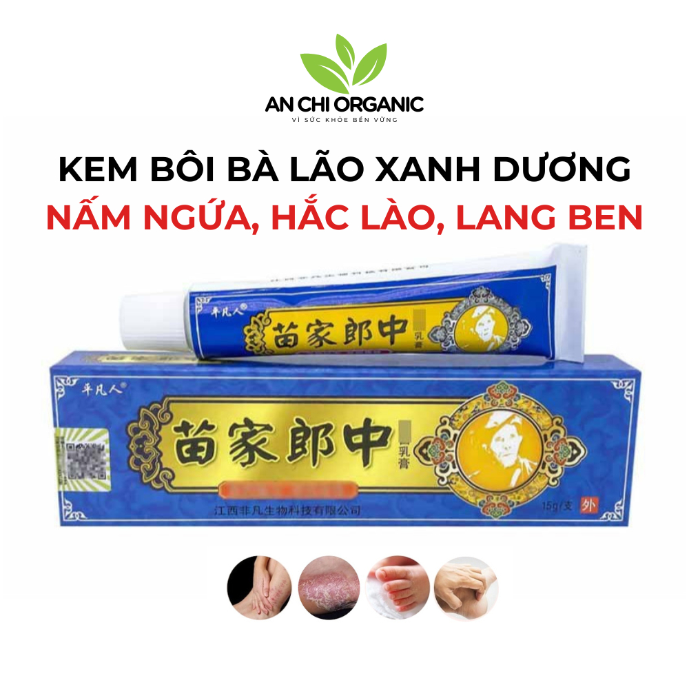 Itchy Fungus Topical Cream to Support Ringworm, Psoriasis, Ringworm ...