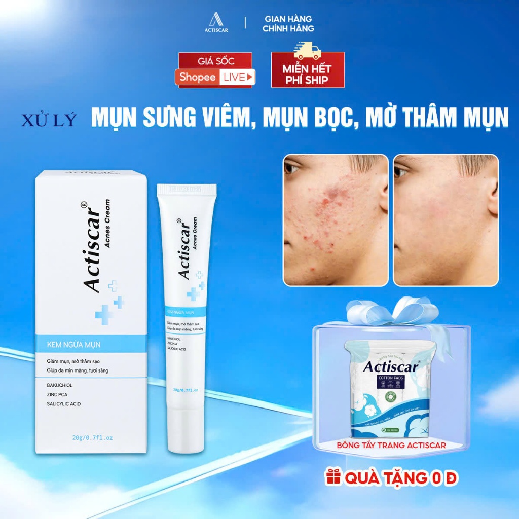 Actiscar Acne Cream to Reduce Swelling, Inflammation, Cysts, Fade Dark ...
