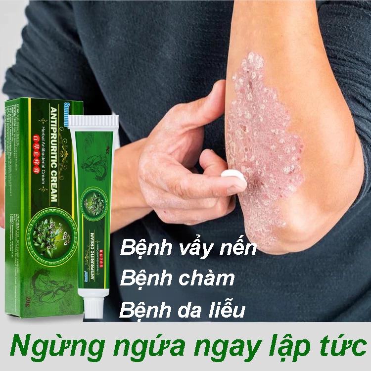 Scabies Support Cream Itchy Fungus Topical Cream Itchy Scabies Topical ...