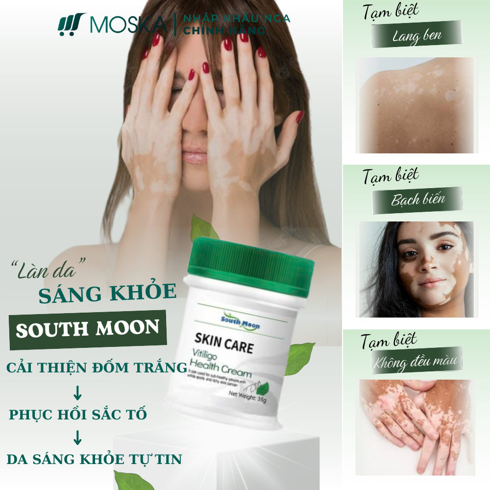 Southmoon American Vitiligo Dissolving Cream, Tinea versicolor, White ...