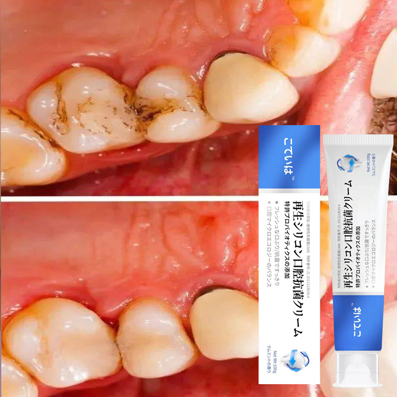 Japanese regenerating Silicone toothpaste to prevent tooth decay ...