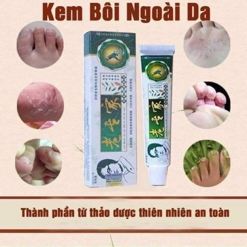 Cream for itchy fungus, ringworm, hives, keratosis, dermatitis ...