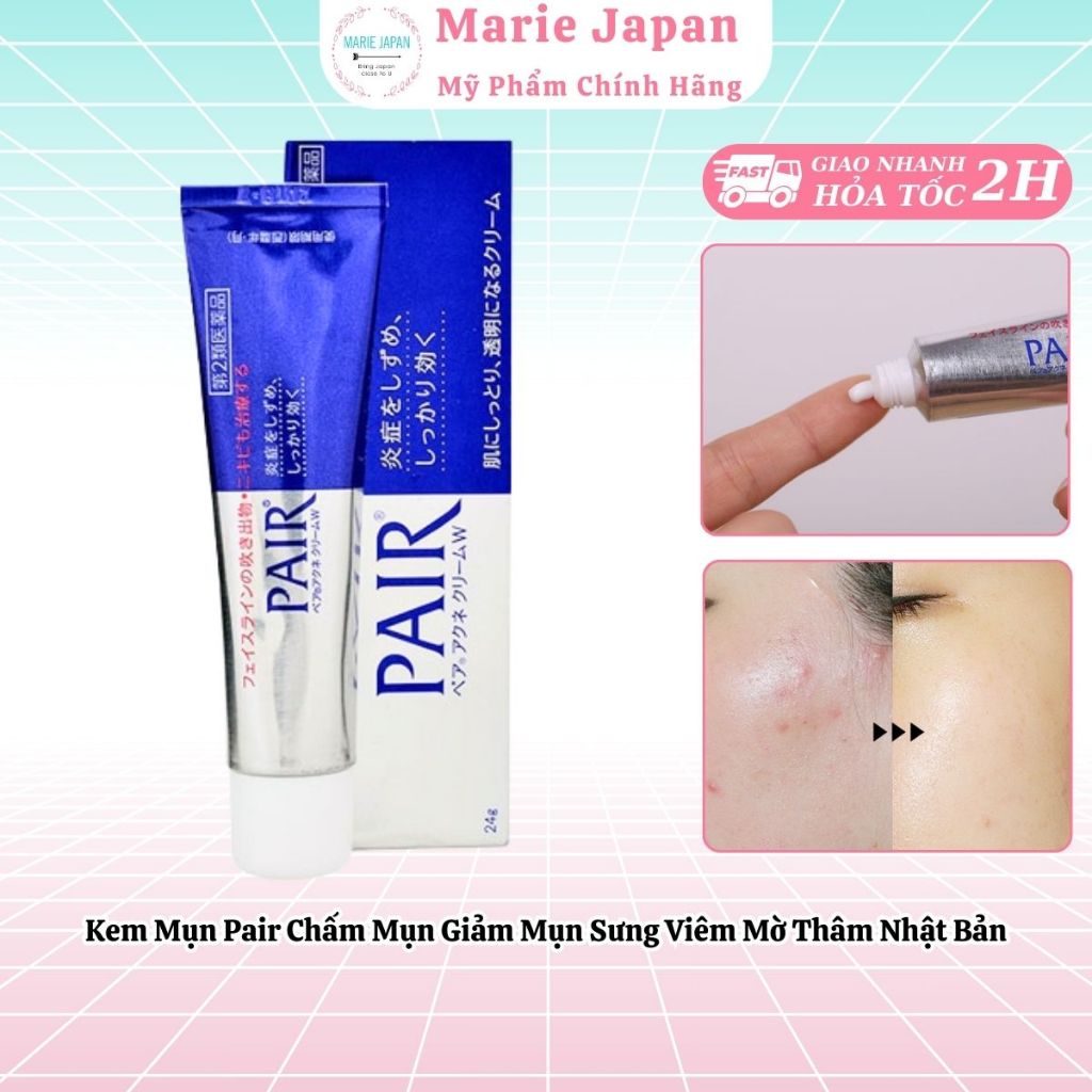 Pair Acne Cream to Reduce Acne, Swelling, Inflammation, Dark Spots ...