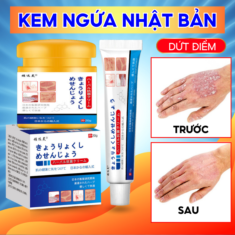 Japanese Atopic Dermatitis Topical Cream Itchy Fungus Topical Cream ...