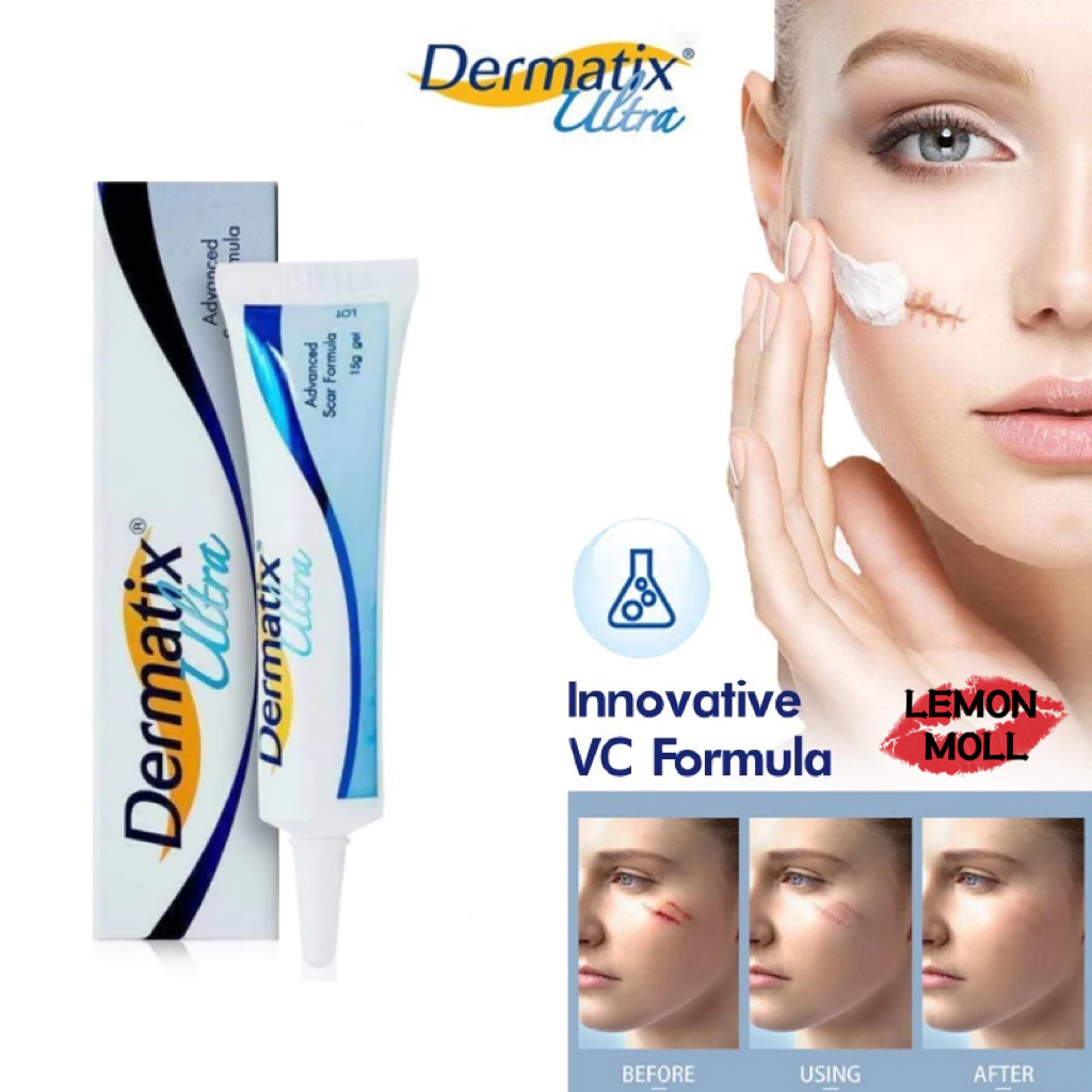 Dermatix Ultra Gel Cream to Fade Dark Scars and Scars 15g | Shopee Malaysia