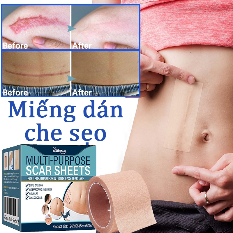 Scar Covering Patches Fade Post-Surgery Scars Keloid Scar Fading ...