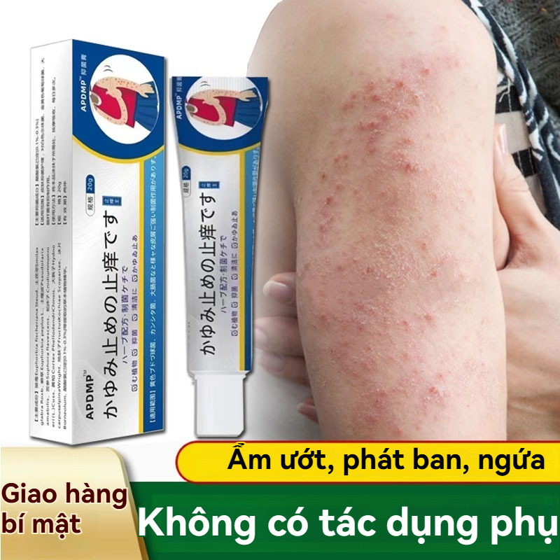 Skin Cream for Itchy Fungus, Ringworm, Eczema, Scabies, Leech's Nest ...