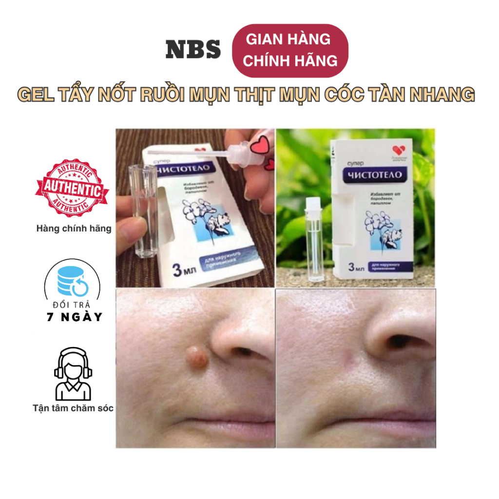 Develinil Russian mole, wart, skin tag removal Gel 3ml | Shopee Malaysia