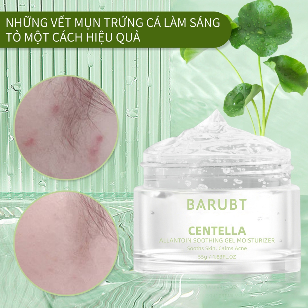 Barubt Gentle Cream - Moisturizes, Soothes Skin, Supports Acne ...