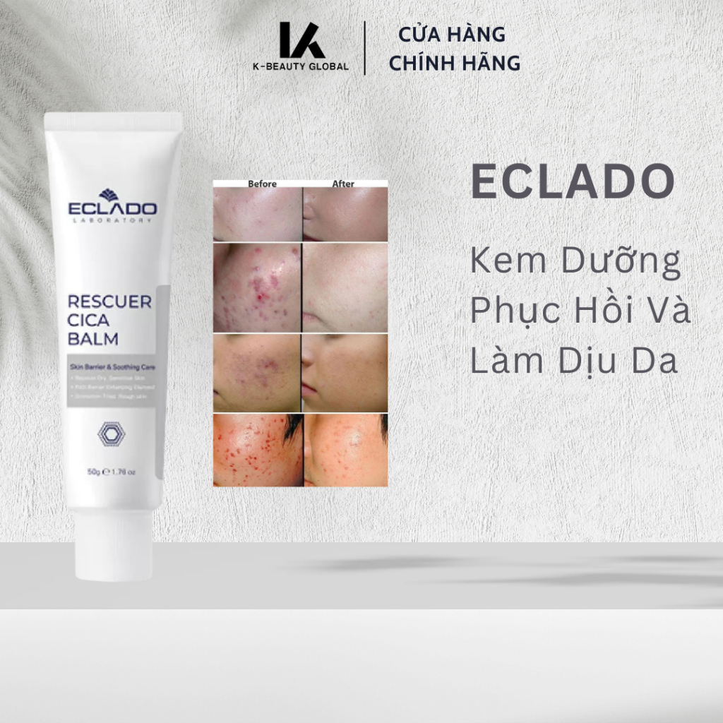 Eclado Rescuer Cica Balm 50g | Shopee Malaysia