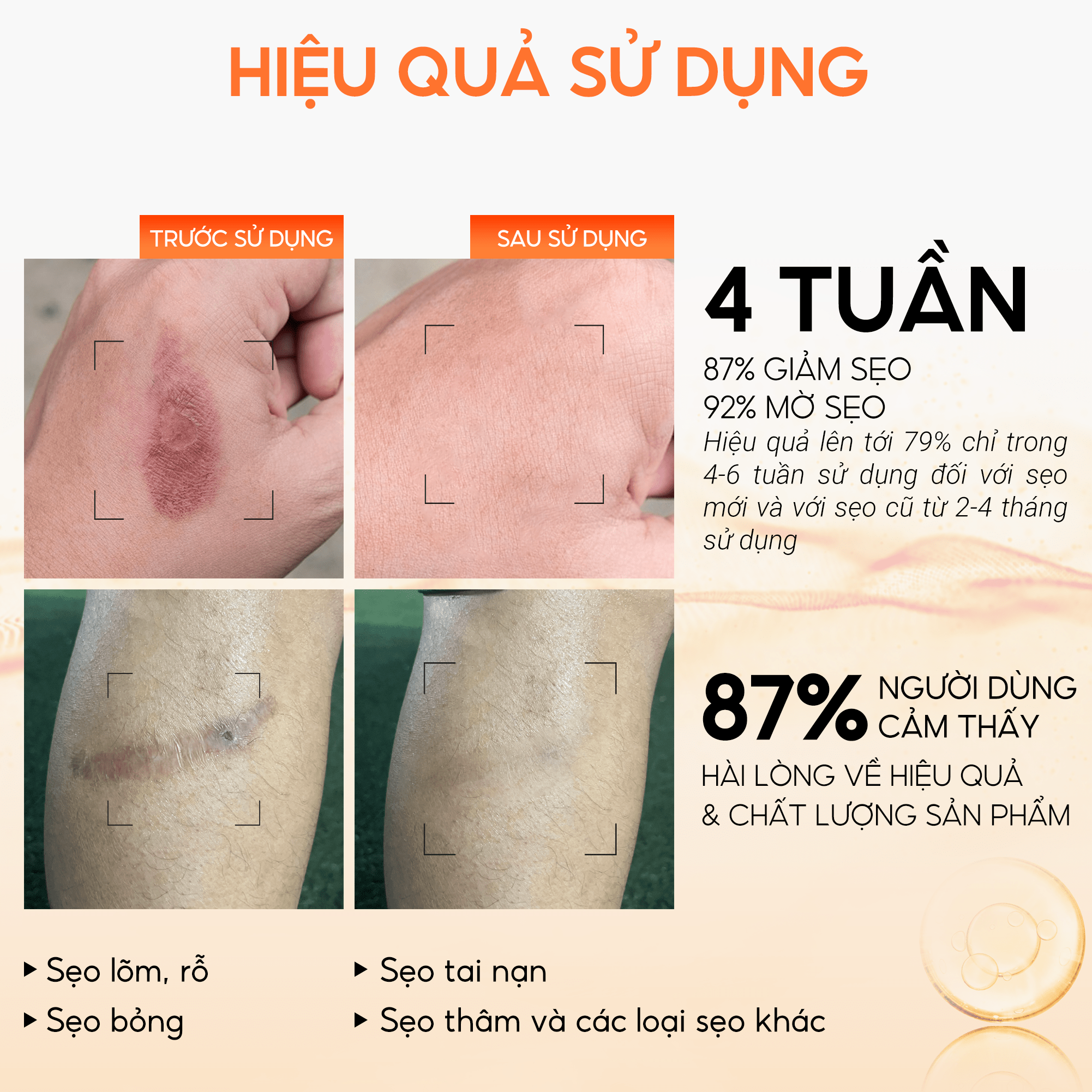 Abera Scar Red Turmeric Scar Cream 20gram - Supports Scar Fade, Reduces ...