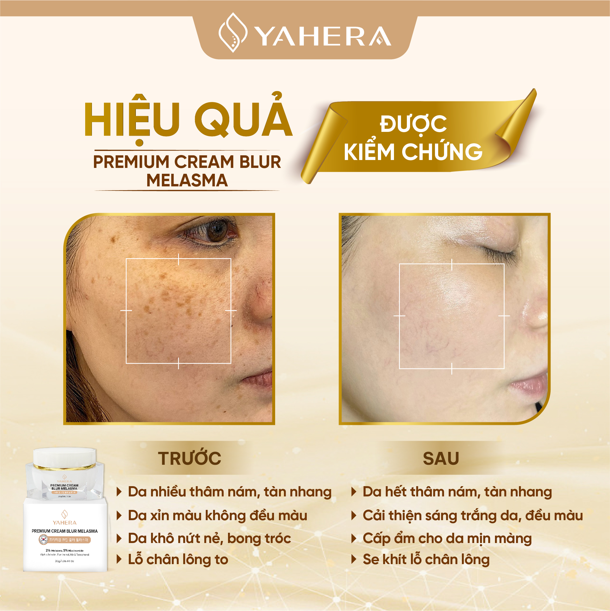 Fade Cream YAHERA Premium Cream Blur Melasma Slingshotm freckles, anti ...