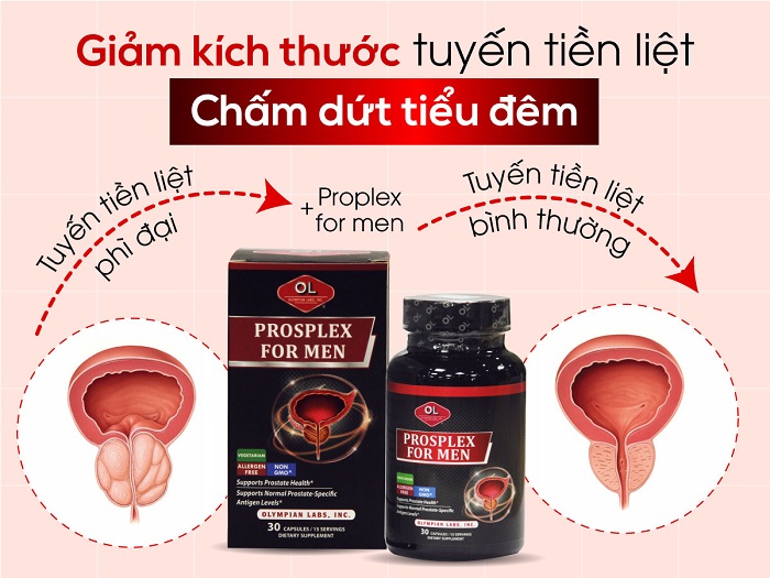 Prosplex For Men Olympian Labs prostate support pills 30 pills increase ...